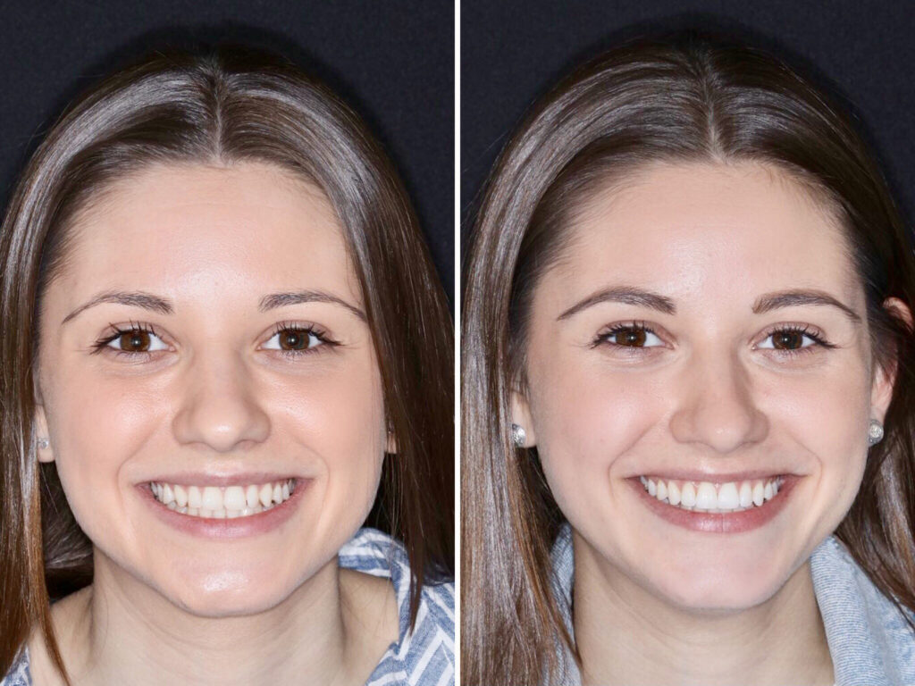 Katie - Love Teeth Dental
