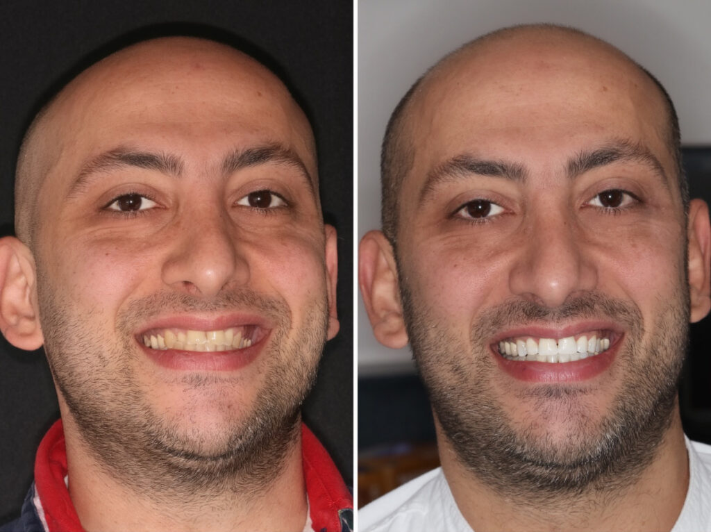 Patient Story - Love Teeth Dental