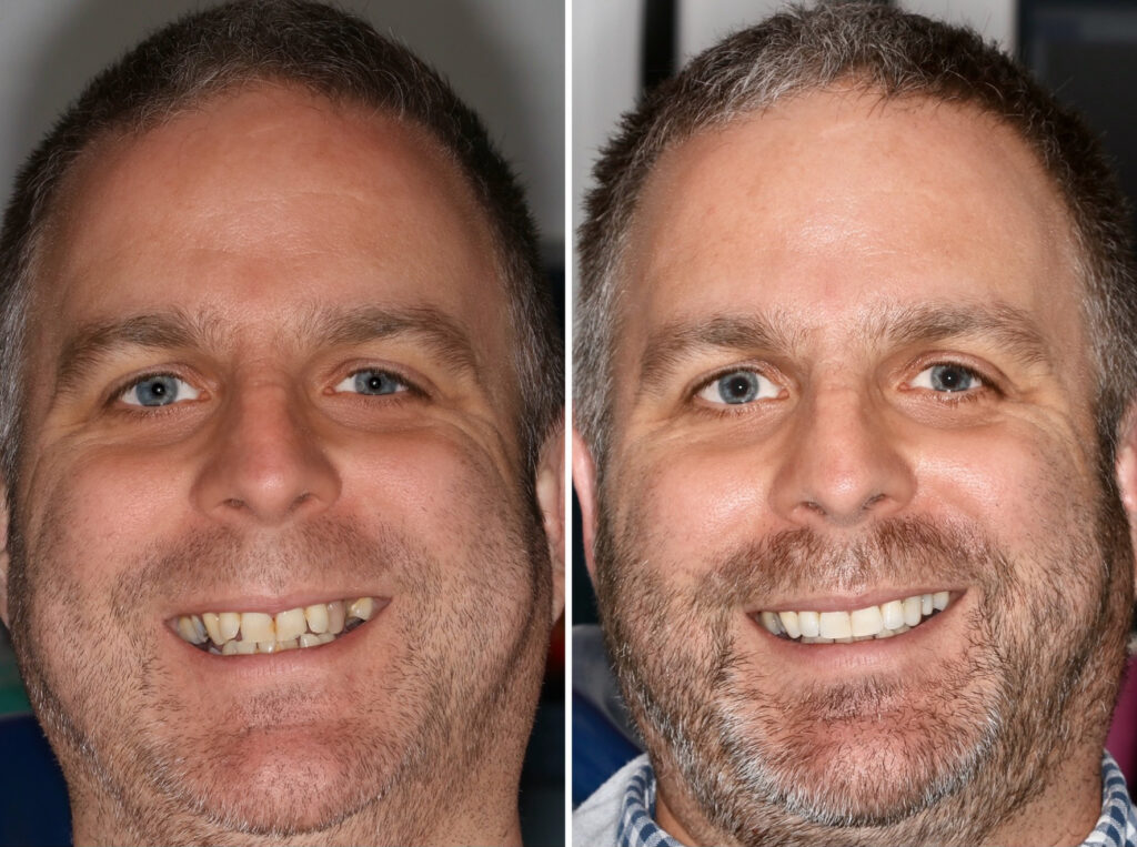 Patient Story - Love Teeth Dental