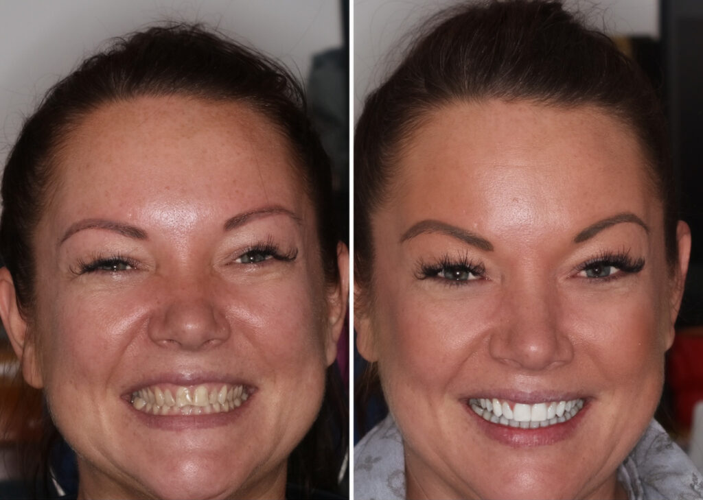 Claire - Love Teeth Dental