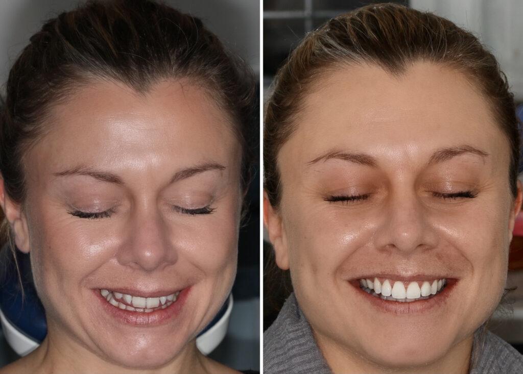 Patient Story - Love Teeth Dental