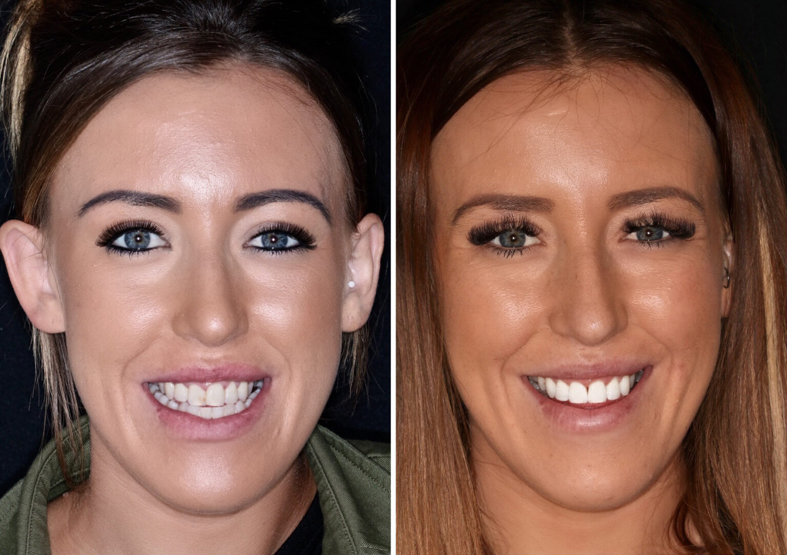 Sophie - Love Teeth Dental